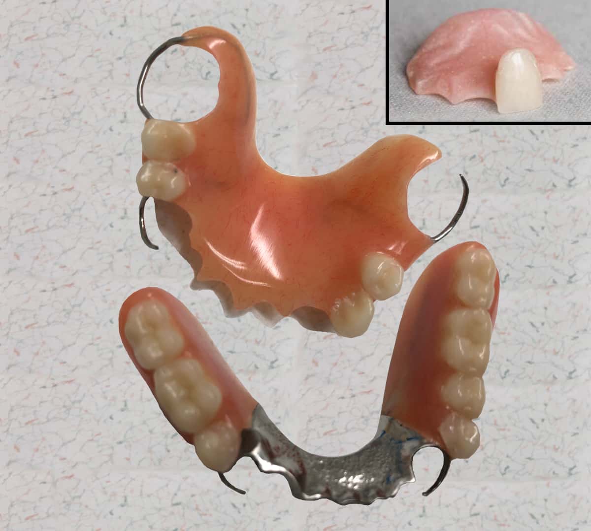 Why Teeth Loss: Periodontal Disease & Gum/Bone Shrinkage | Grantham ...
